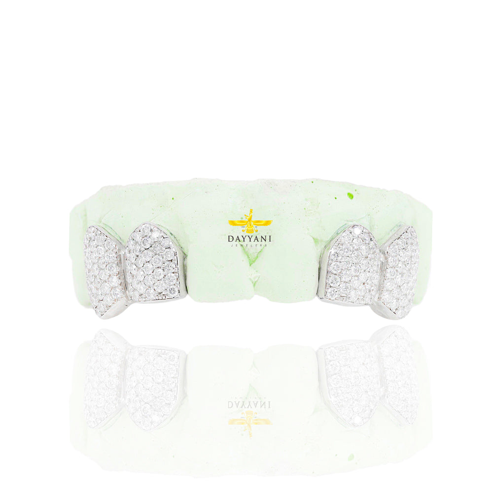 Custom 4 Teeth Diamond Grillz with Back Bar Gold Grillz