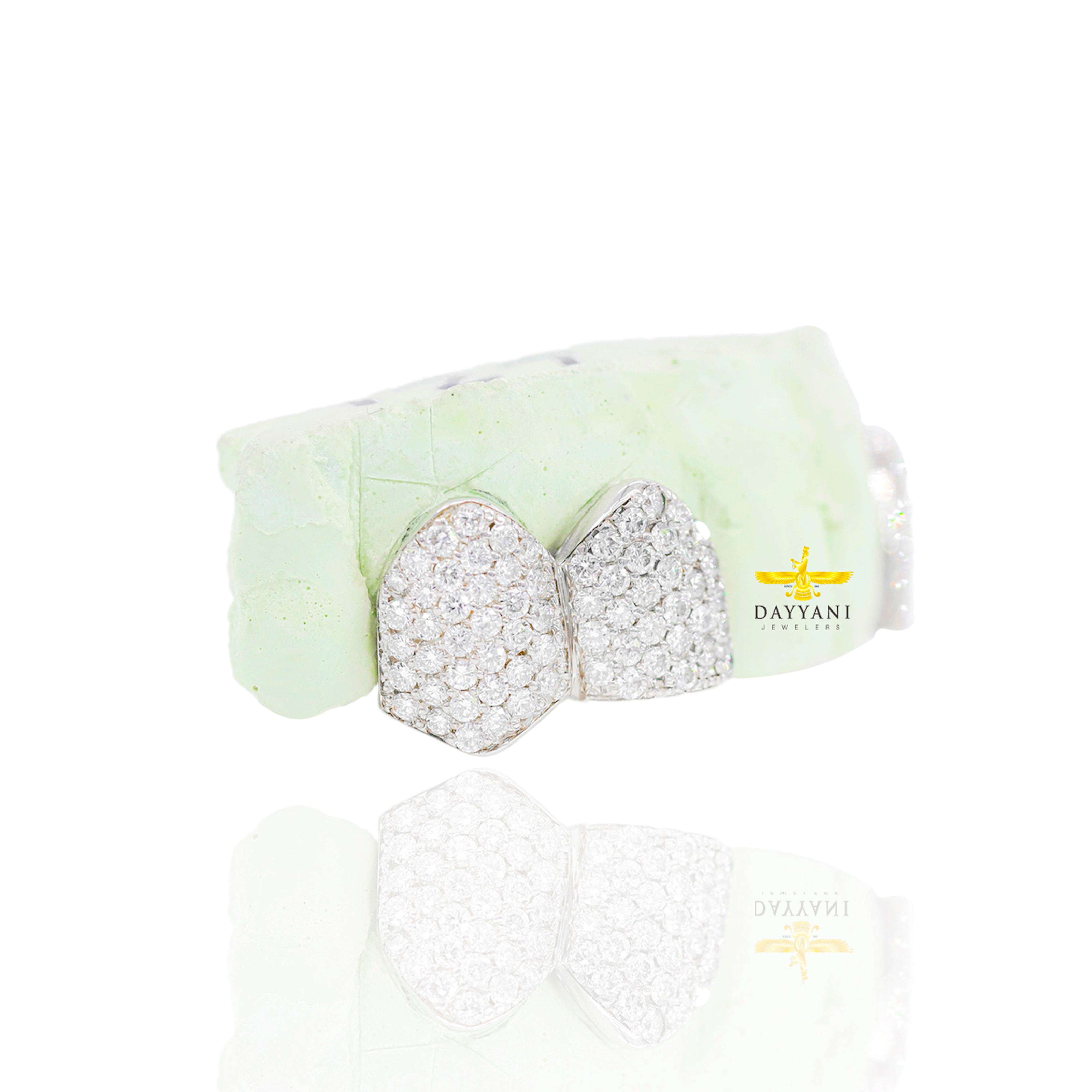 Custom 4 Teeth Diamond Grillz with Back Bar Gold Grillz