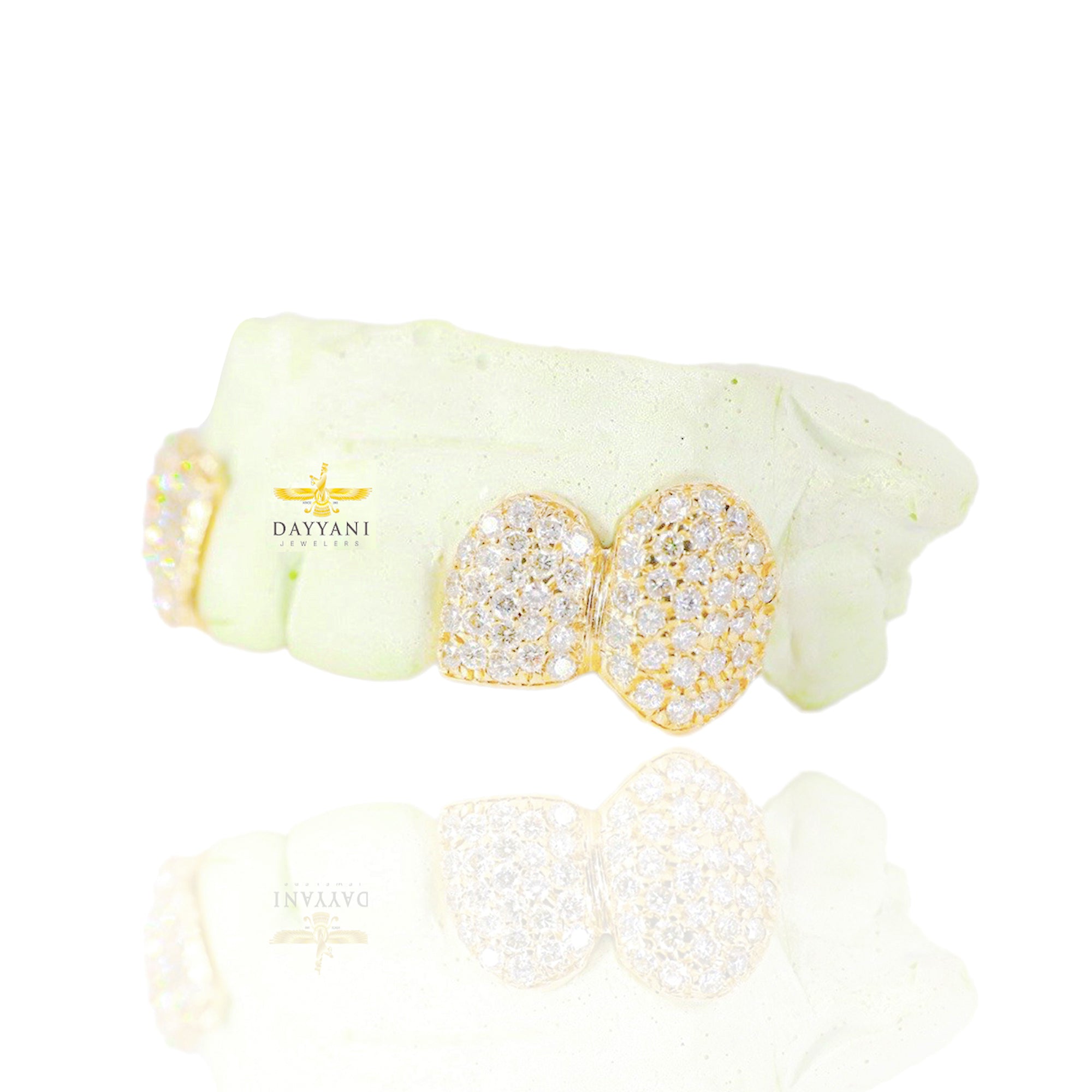 Custom 4 Teeth Diamond Grillz with Back Bar Gold Grillz