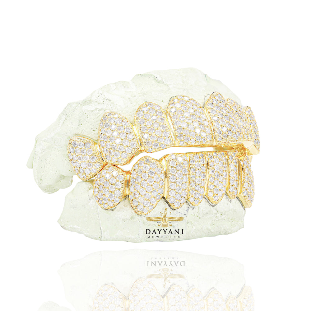 Custom I Clarity Natural Diamond Gold Grillz (Zig-Zag Setting)