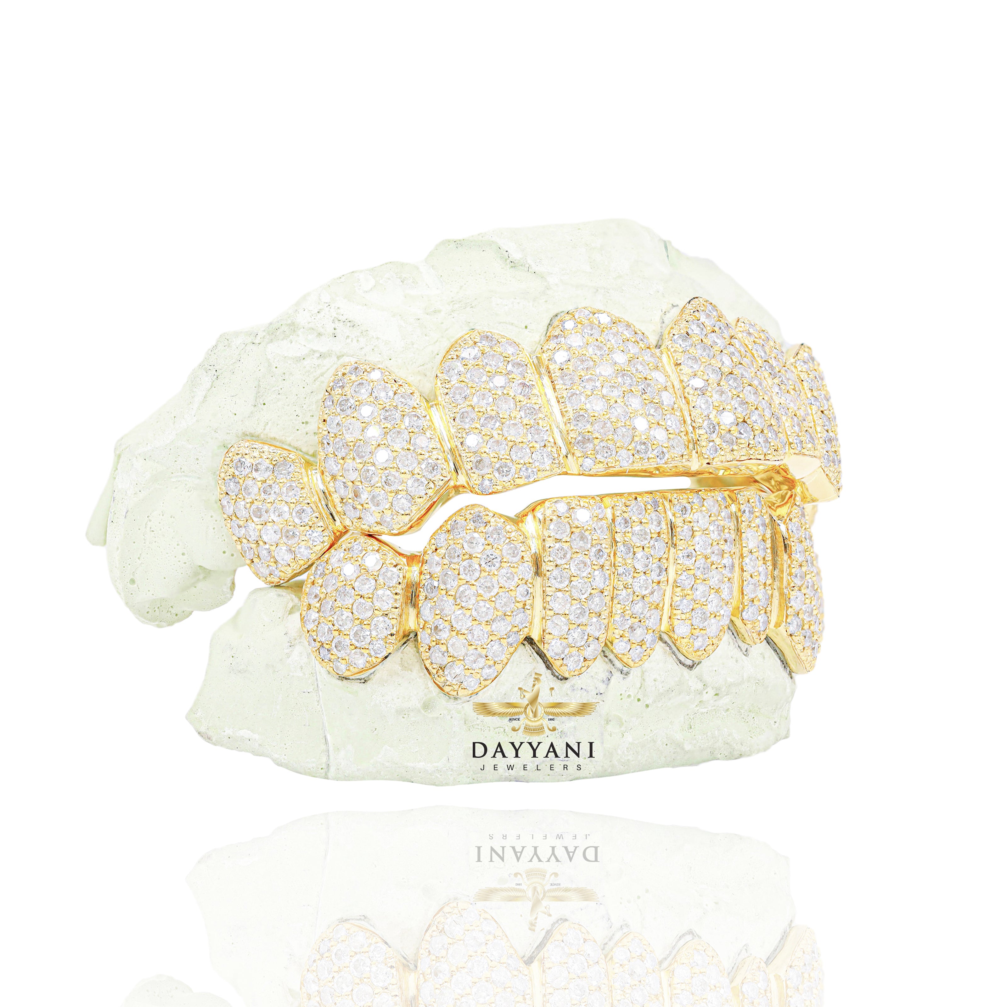 Custom I Clarity Natural Diamond Gold Grillz (Zig-Zag Setting)