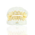 Custom Diamond Dust Gold Grillz