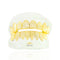 Custom Diamond Dust Gold Grillz