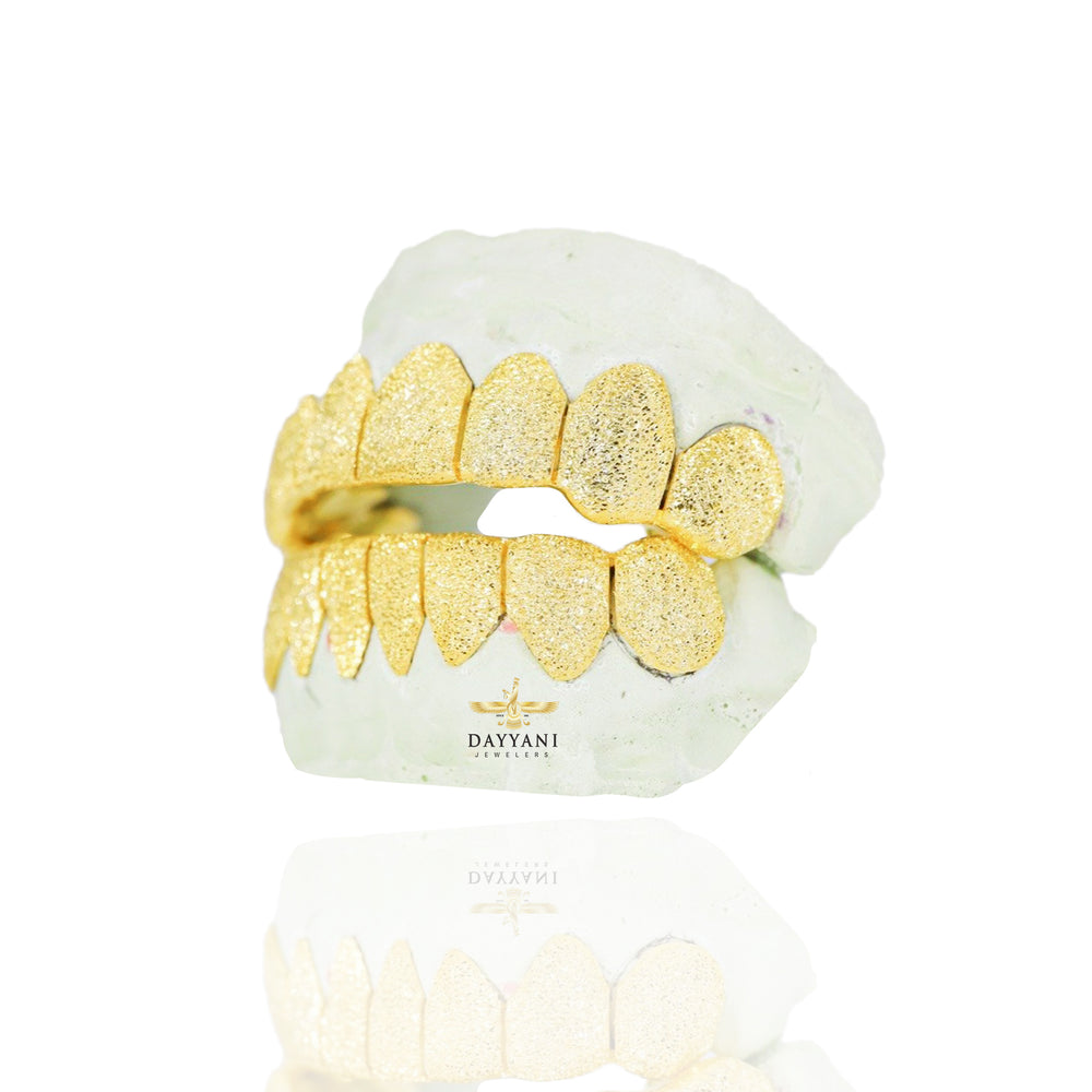 Custom Diamond Dust Gold Grillz