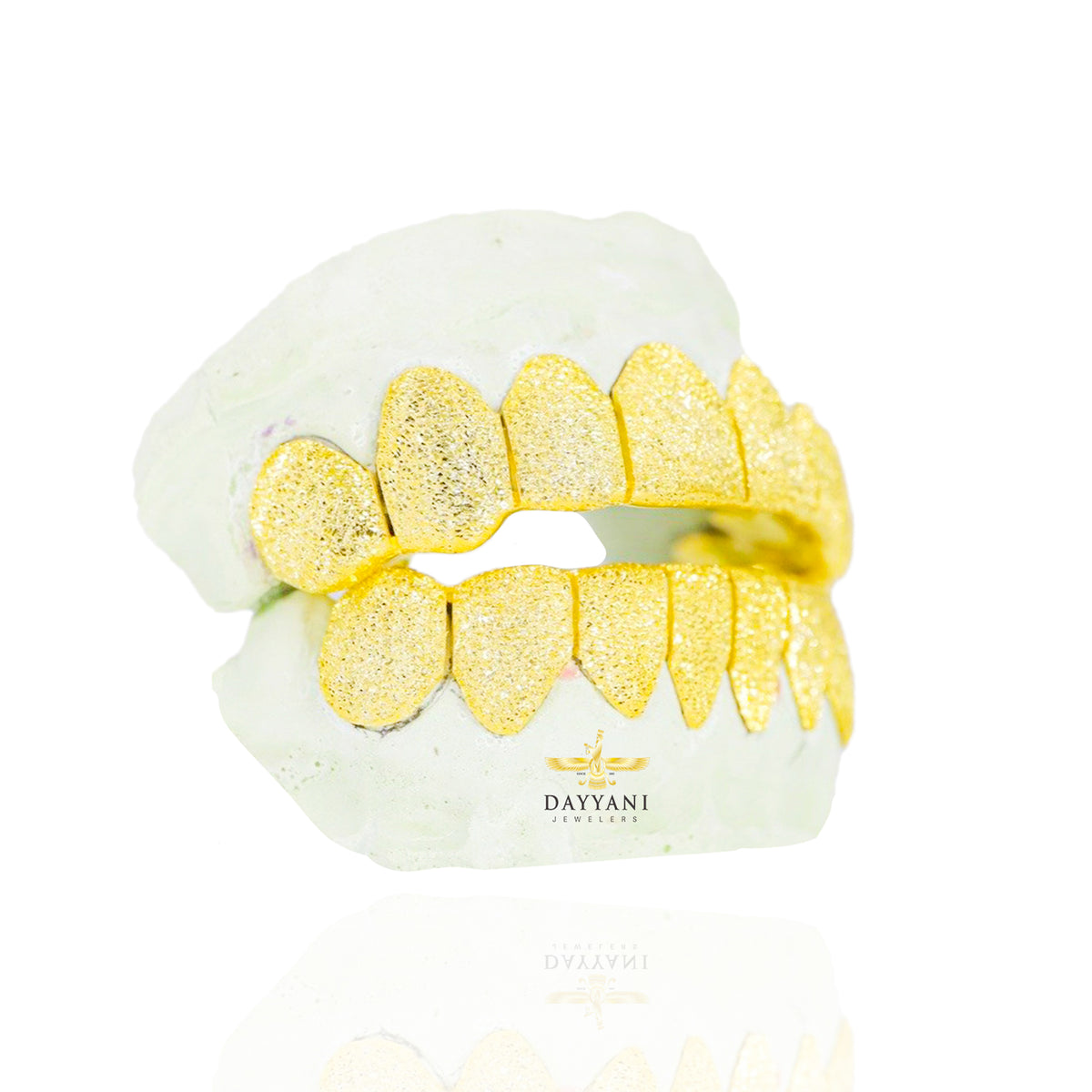 Custom Diamond Dust Gold Grillz