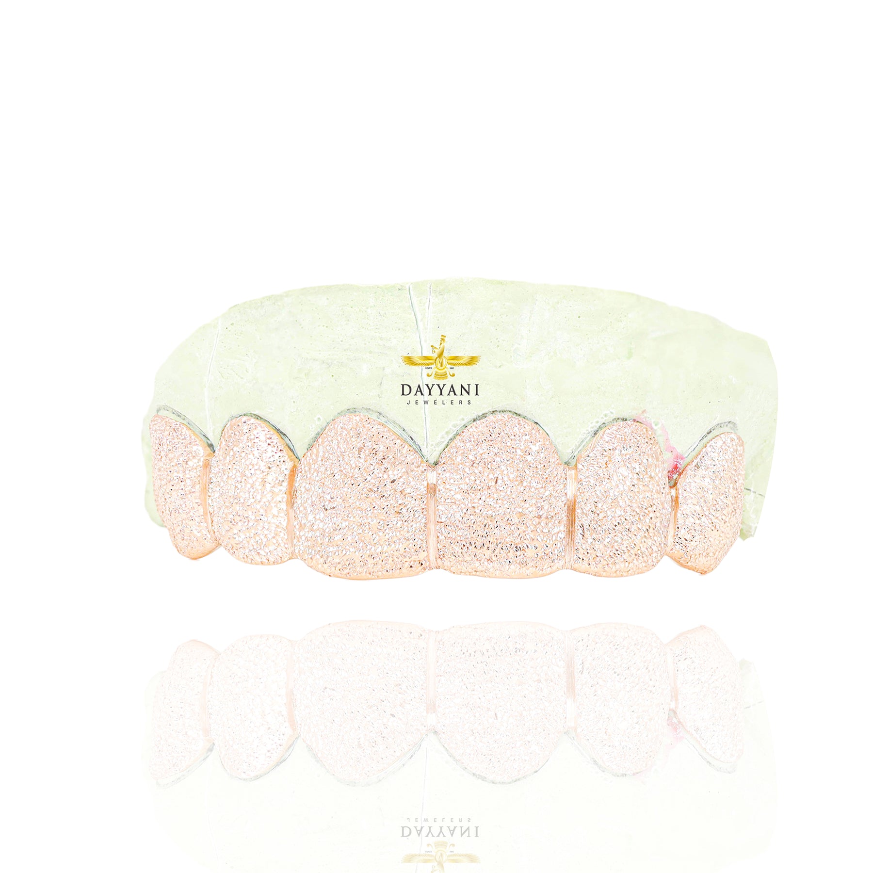 Custom Diamond Dust Gold Grillz