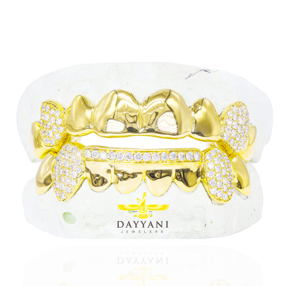 Custom 8 on 8 Teeth Diamond Fangs & Diamond Bar Gold Grillz