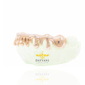 Custom Drip Style Gold Grillz