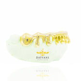 Custom Drip Style Gold Grillz