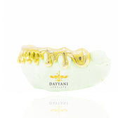 Custom Drip Style Gold Grillz