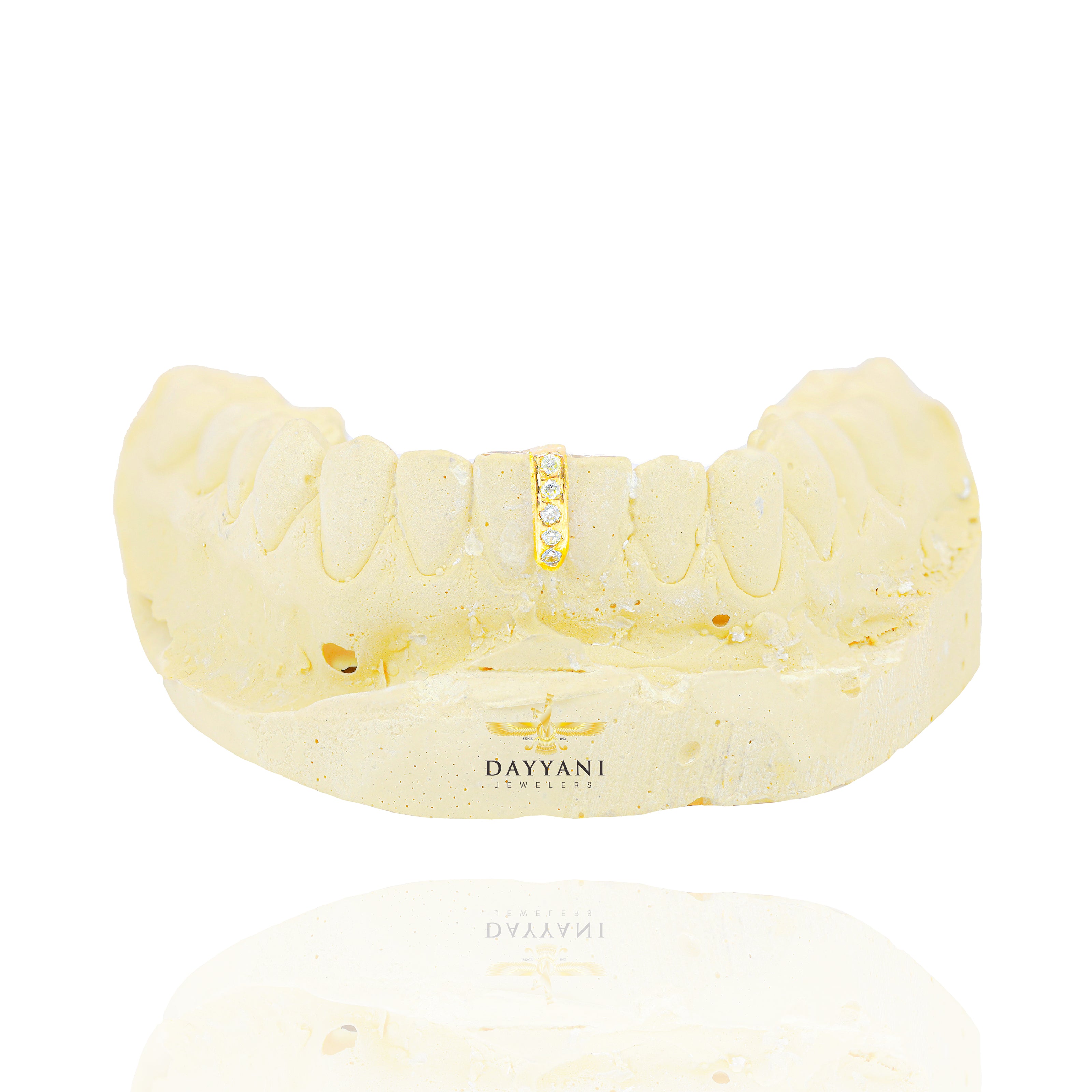 Custom Gold Gap Filler with Diamonds Grillz