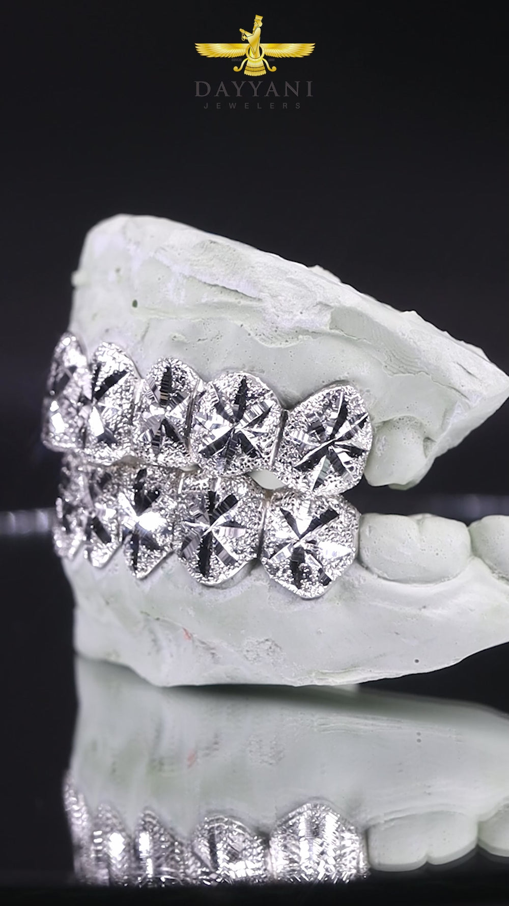 Custom Starburst Diamond Dust Gold Grillz