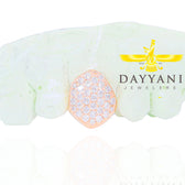 Custom One Tooth Diamond Grillz Hand Set Natural Diamonds Custom Grill