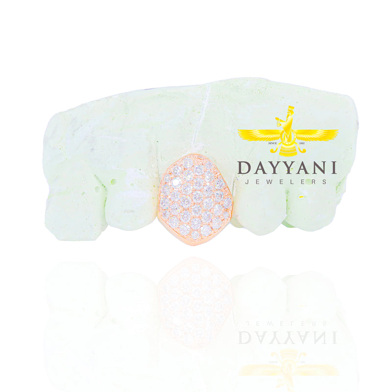 Custom One Tooth Diamond Grillz Hand Set Natural Diamonds Custom Grill