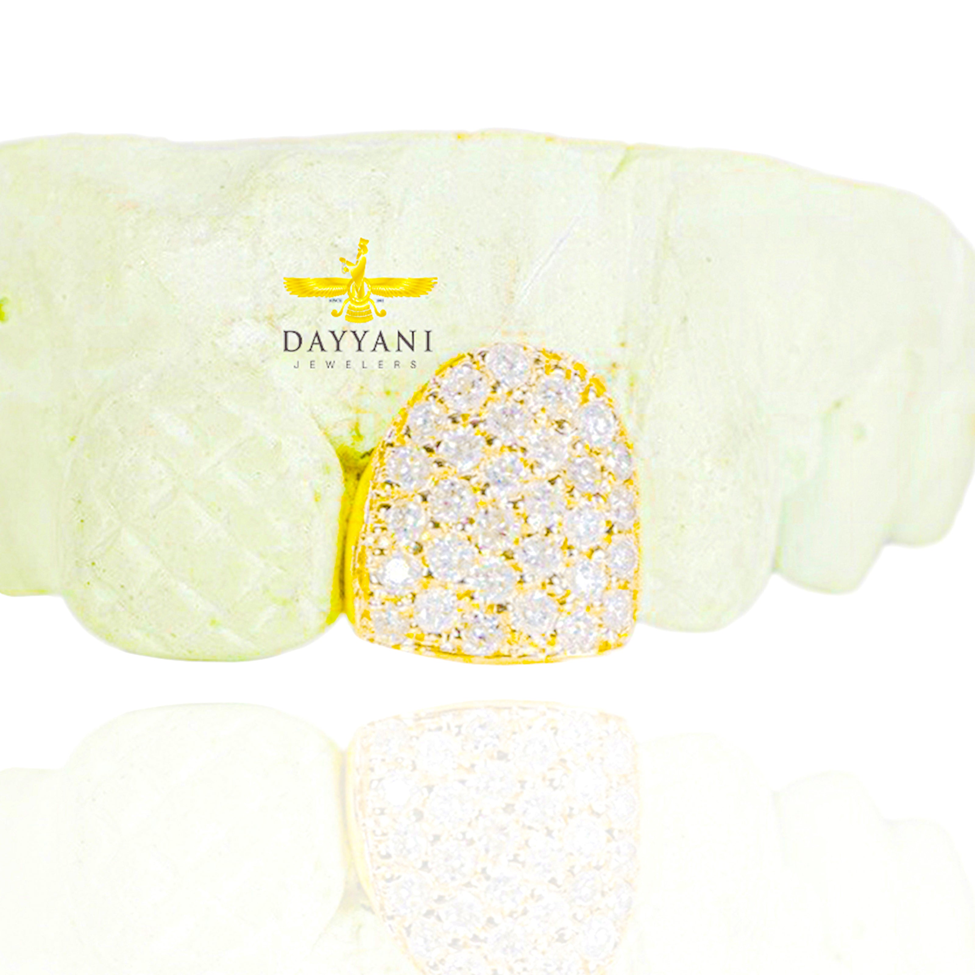 Custom One Tooth Diamond Grillz Hand Set Natural Diamonds Custom Grill