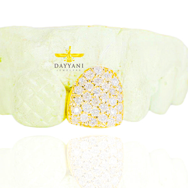 Custom One Tooth Diamond Grillz Hand Set Natural Diamonds Custom Grill