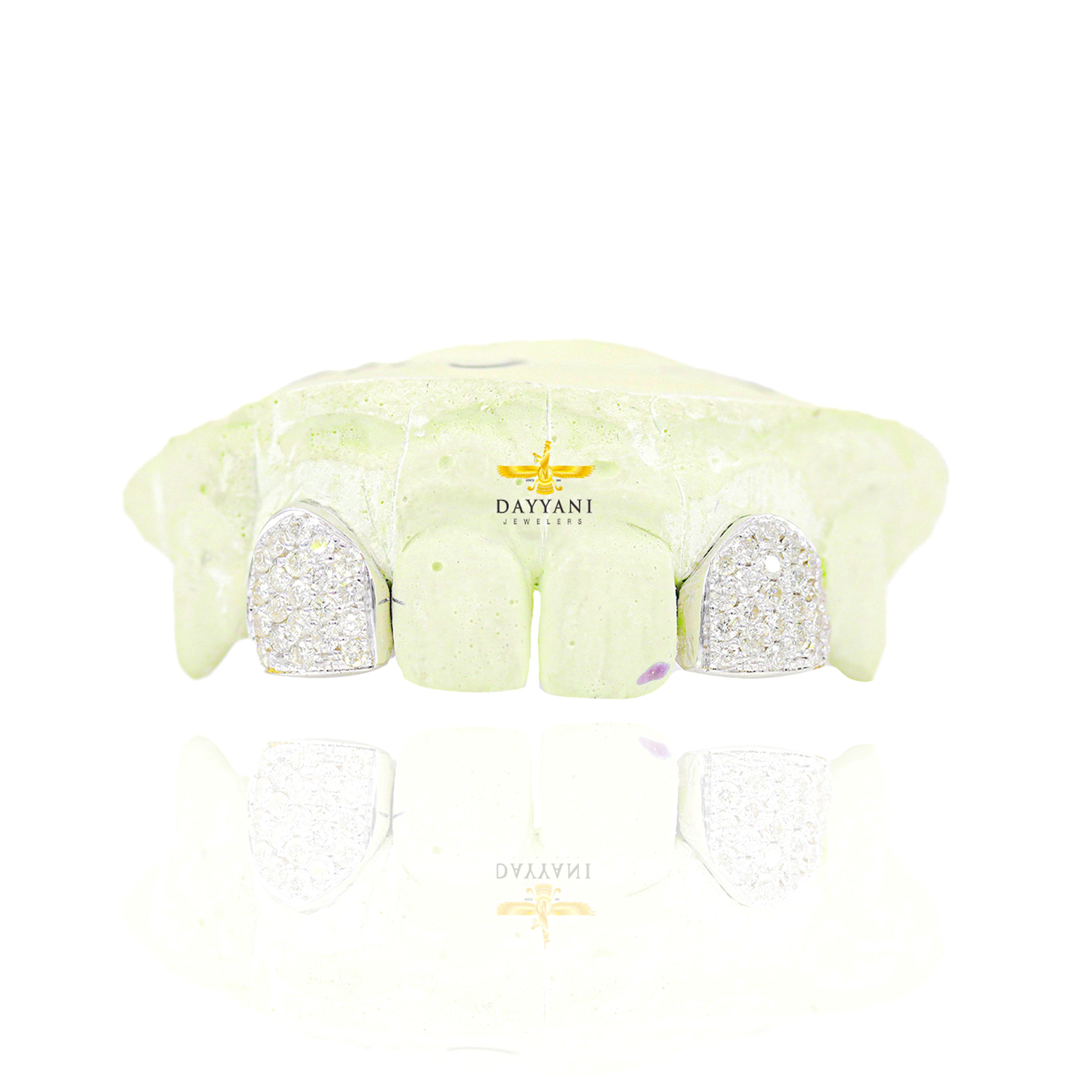 Custom 2 Teeth Incisors Diamond Grillz with Back Bar