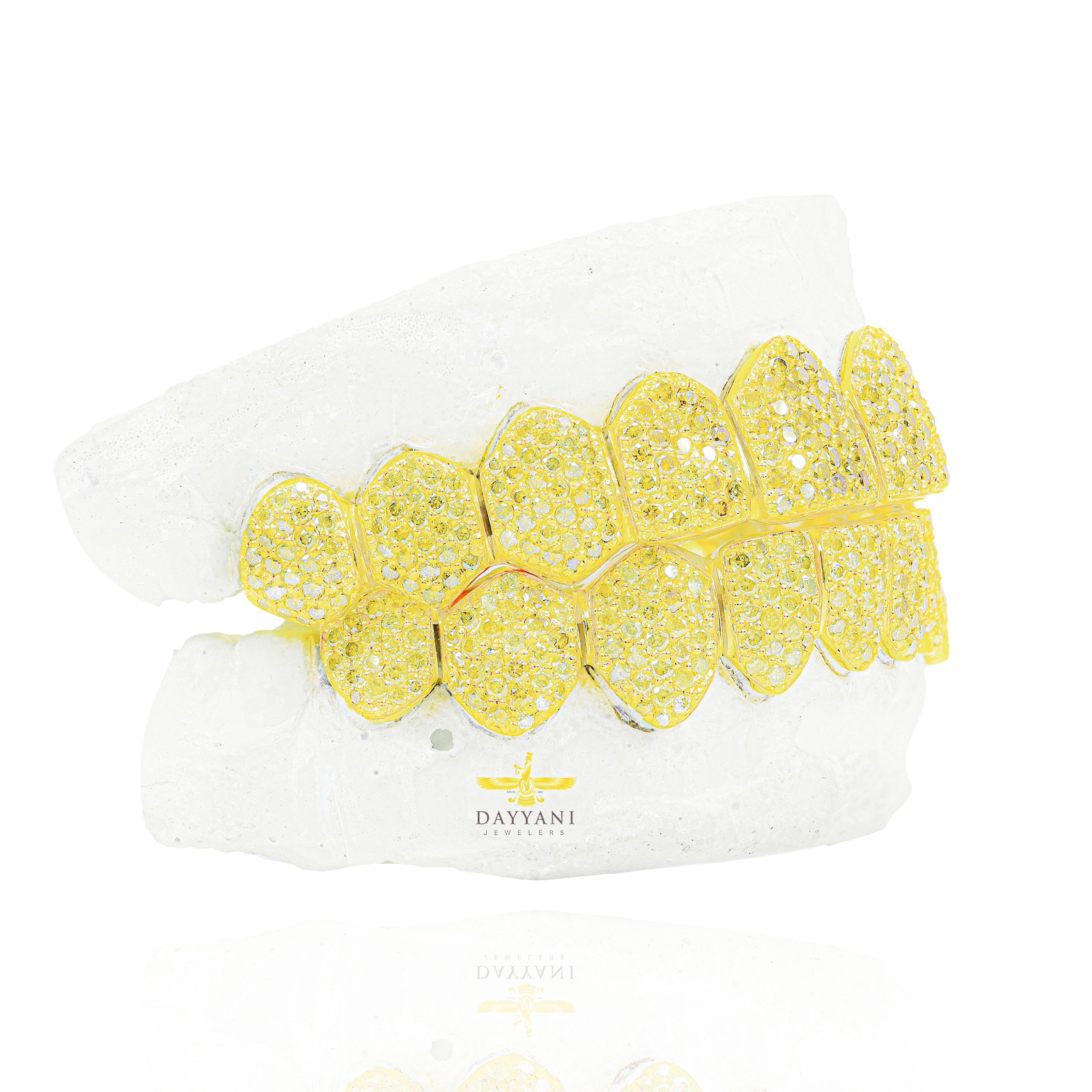 Custom Canary Diamond Gold Grillz (Zig-Zag Setting)