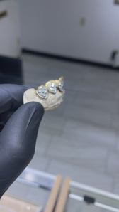 Custom Two-Tone Diamond Cut & Diamond Dust w/ Solid Trim Gold Grillz