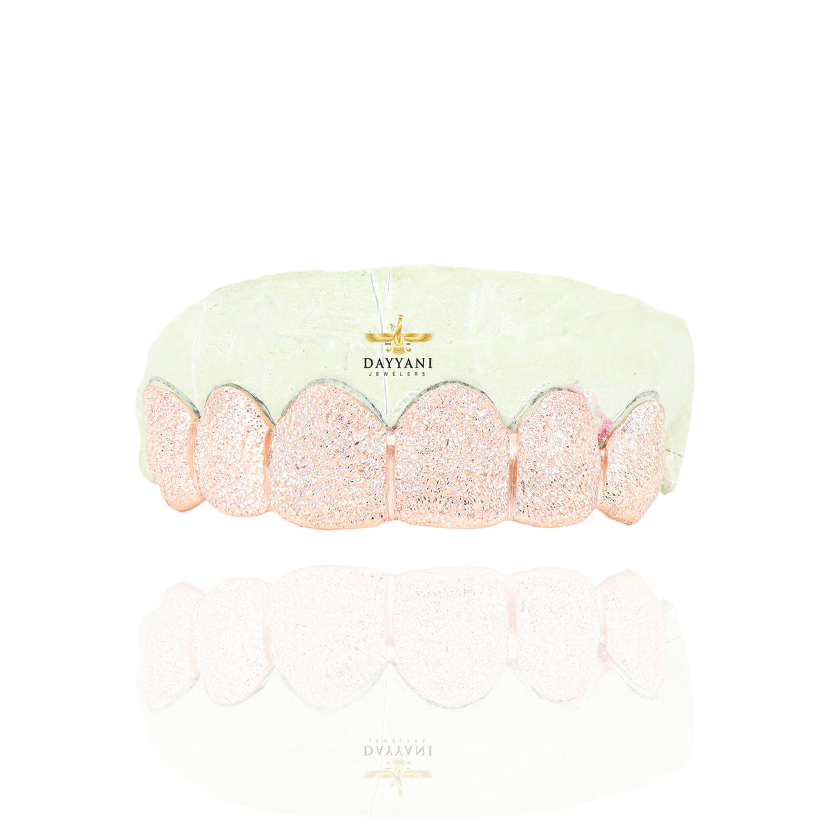 Custom Diamond Dust Gold Grillz