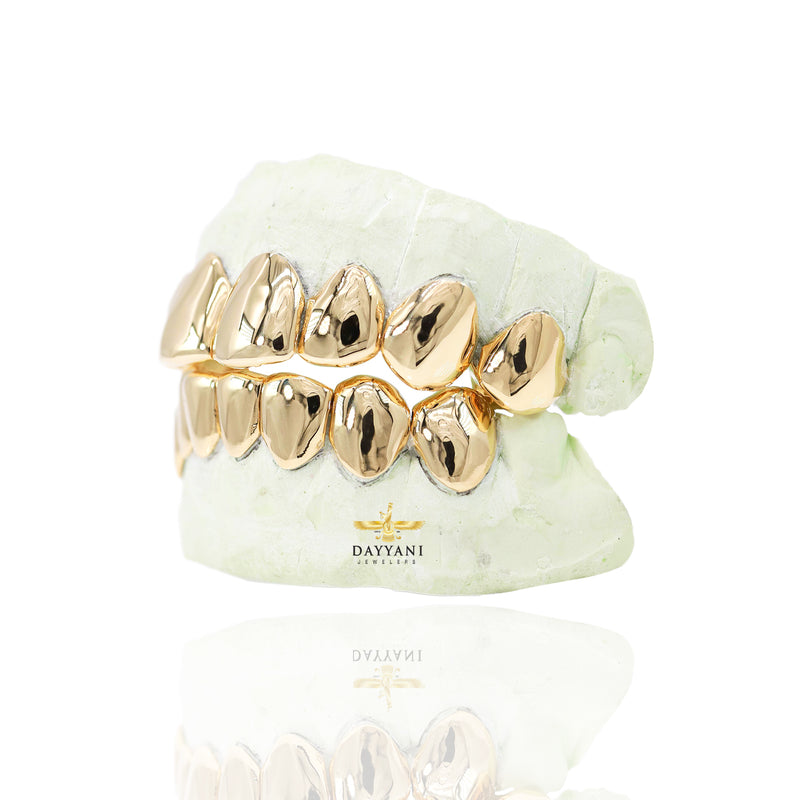 Custom Grillz Solid Gold Grillz