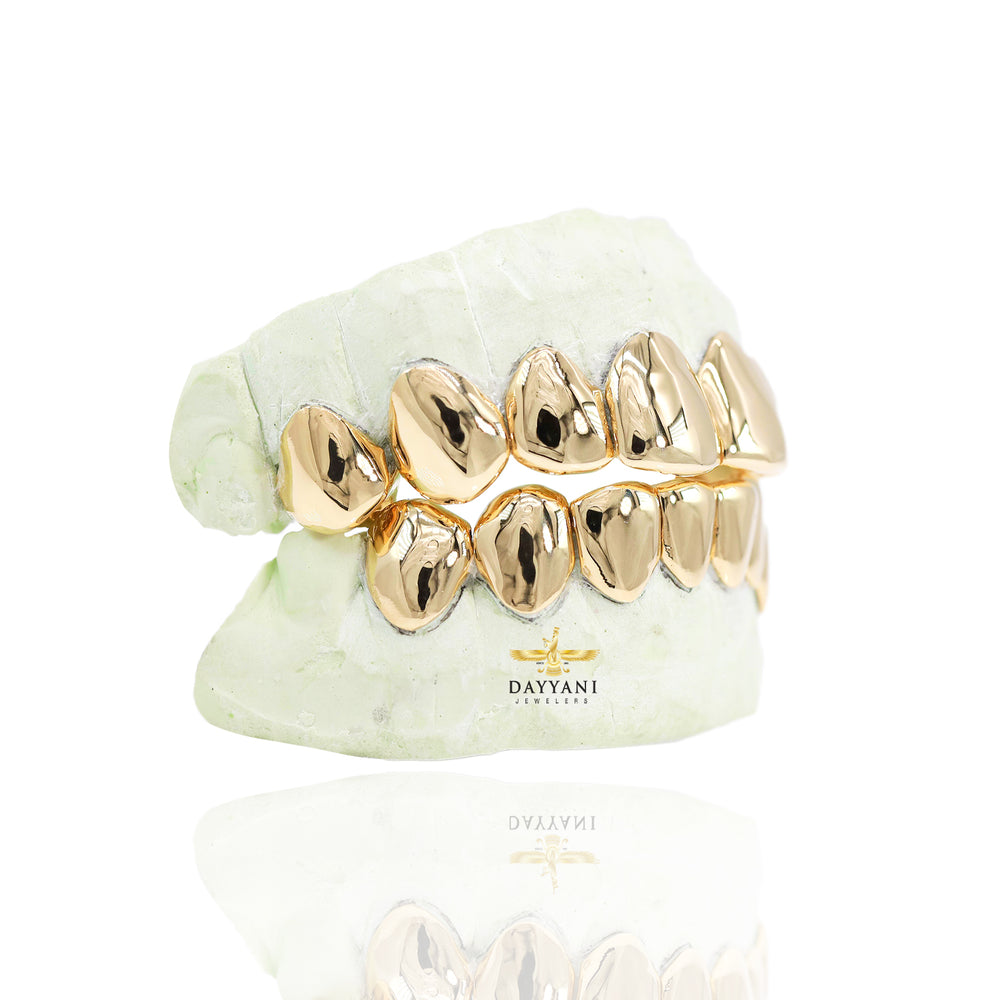 Custom Grillz Solid Gold Grillz